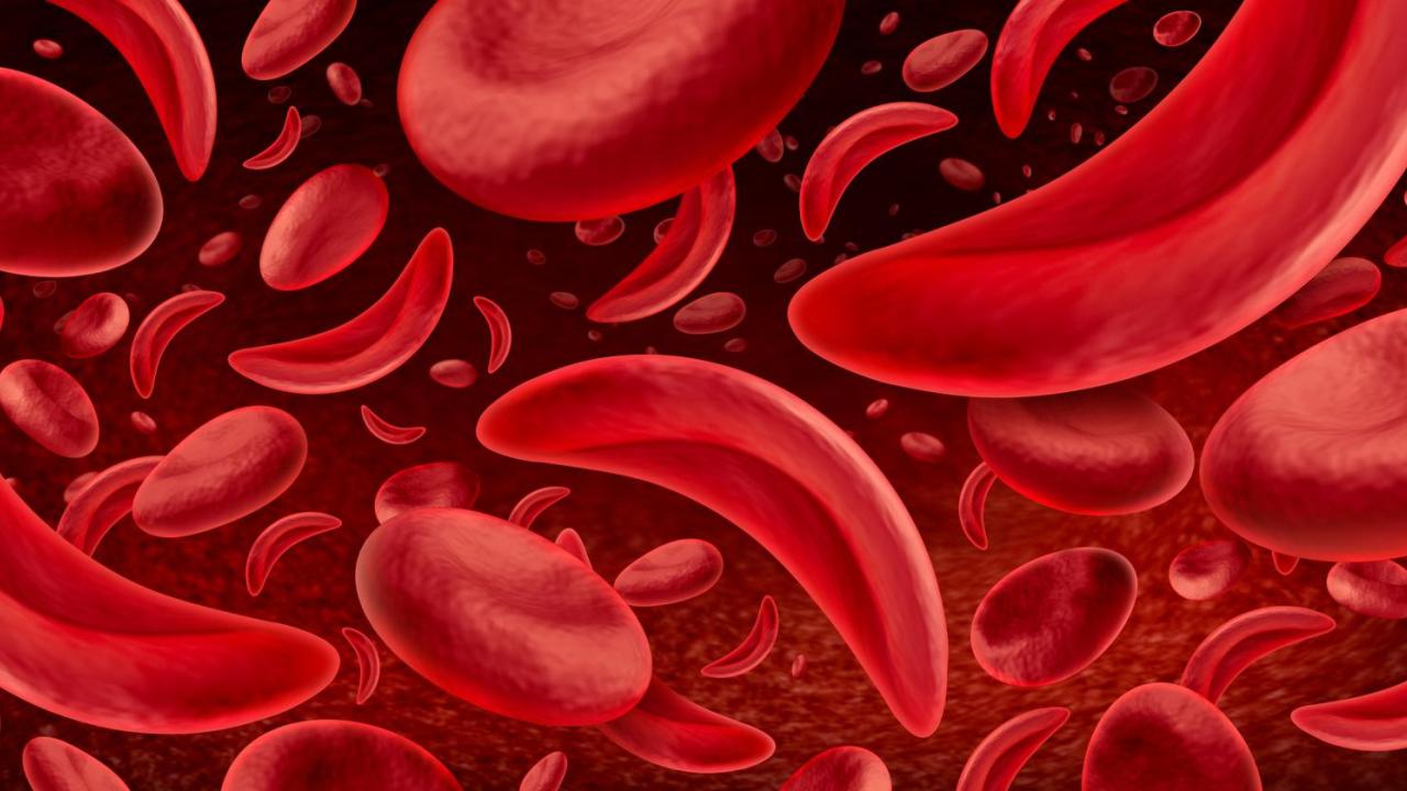 New Intervention May Be a Path to a Better Quality of Life for ...